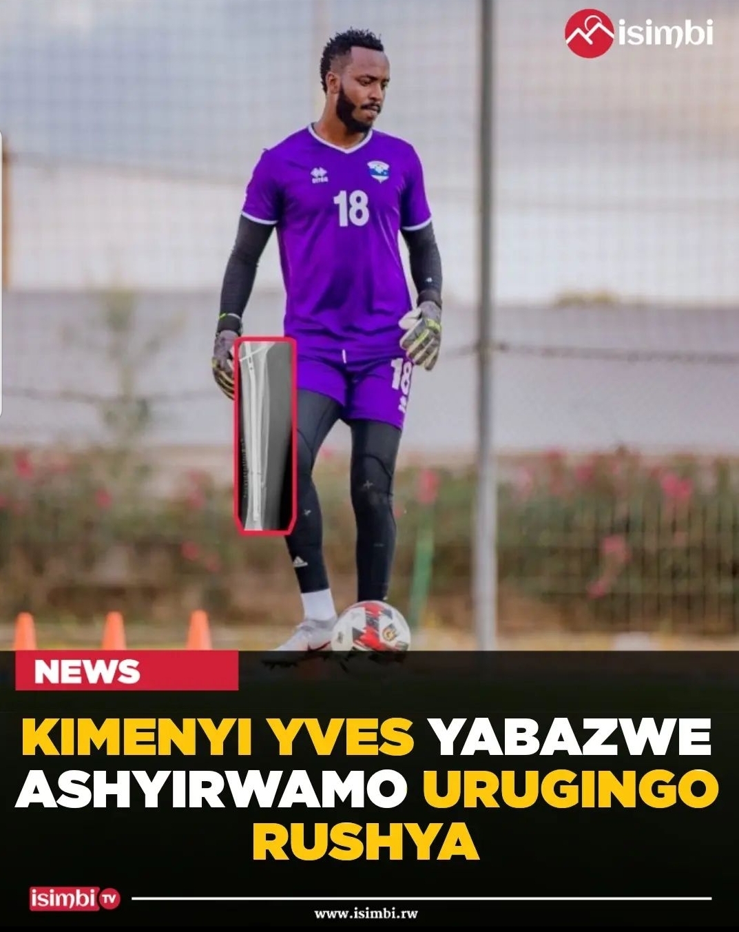 Nyuma y’imvune ya Kimenyi Yves umukunzi we Uwase Muyango (…)